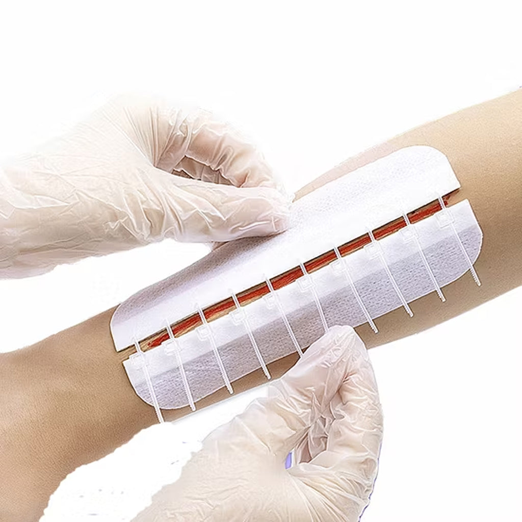 Wound Closure – Ram Medical